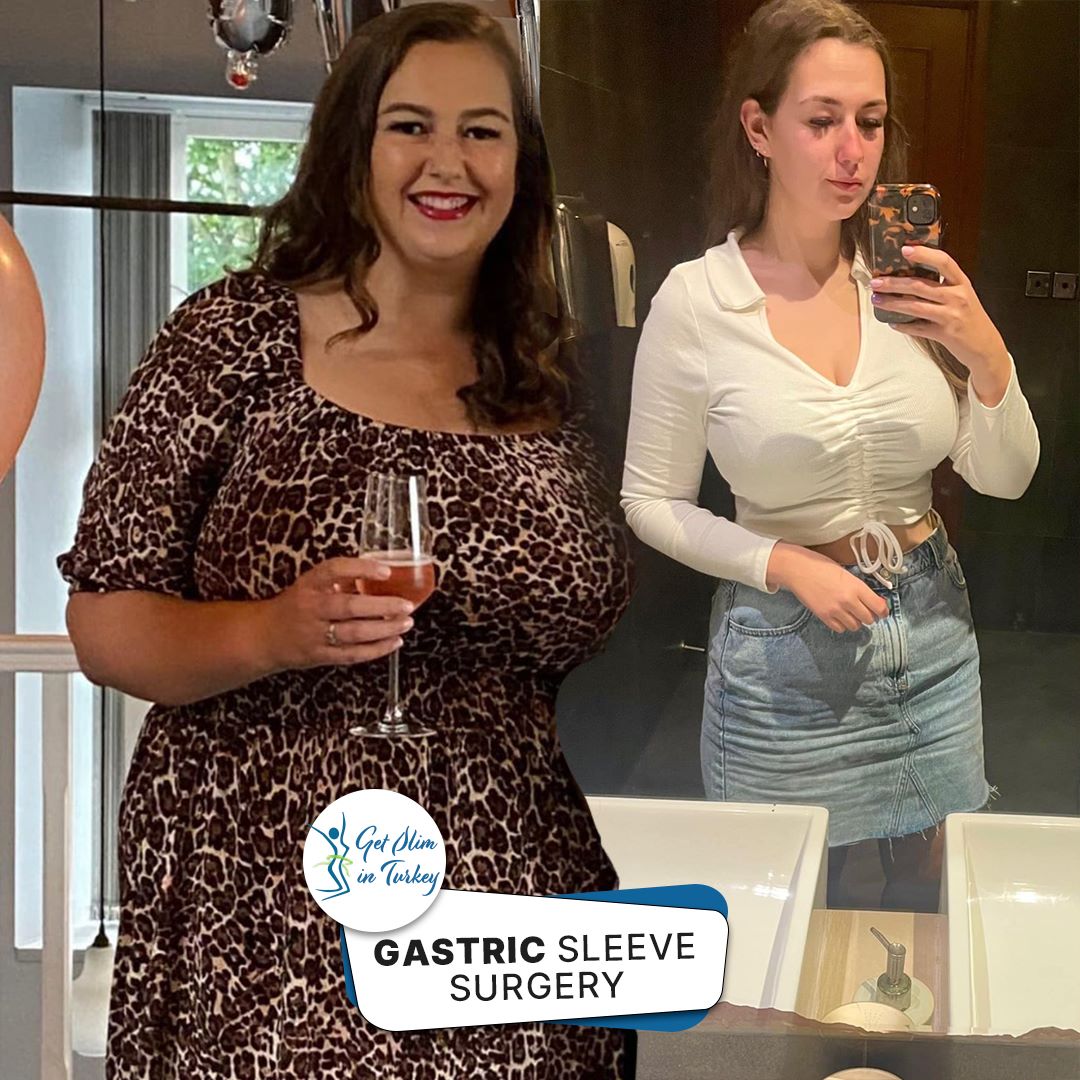 Get Slim in Turkey | Home