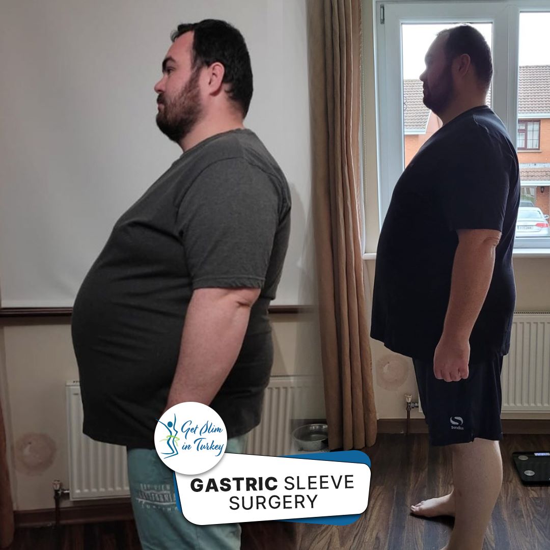 Get Slim in Turkey | Home